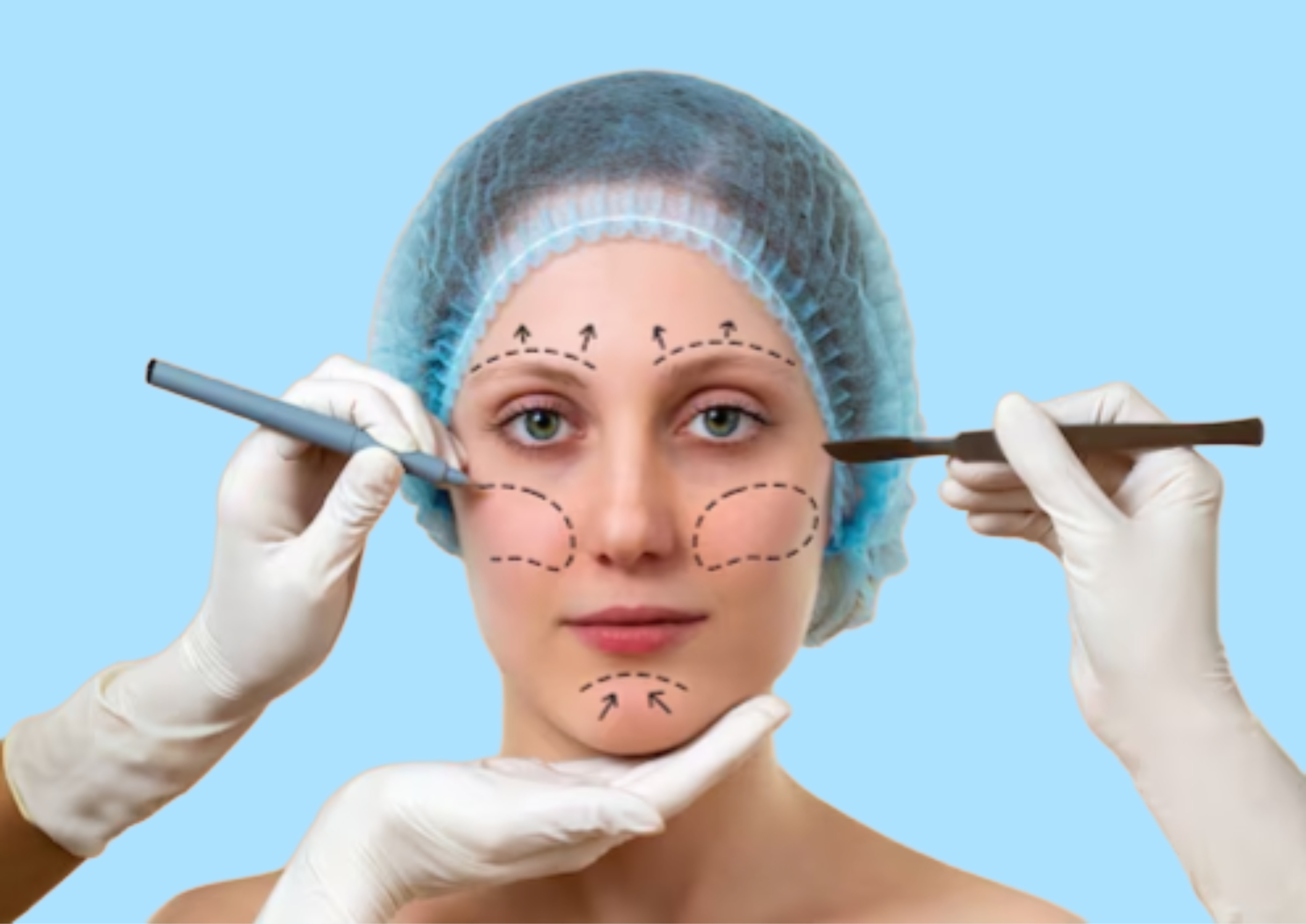 Face & Neck Lift – Esthetic Surgery Travel